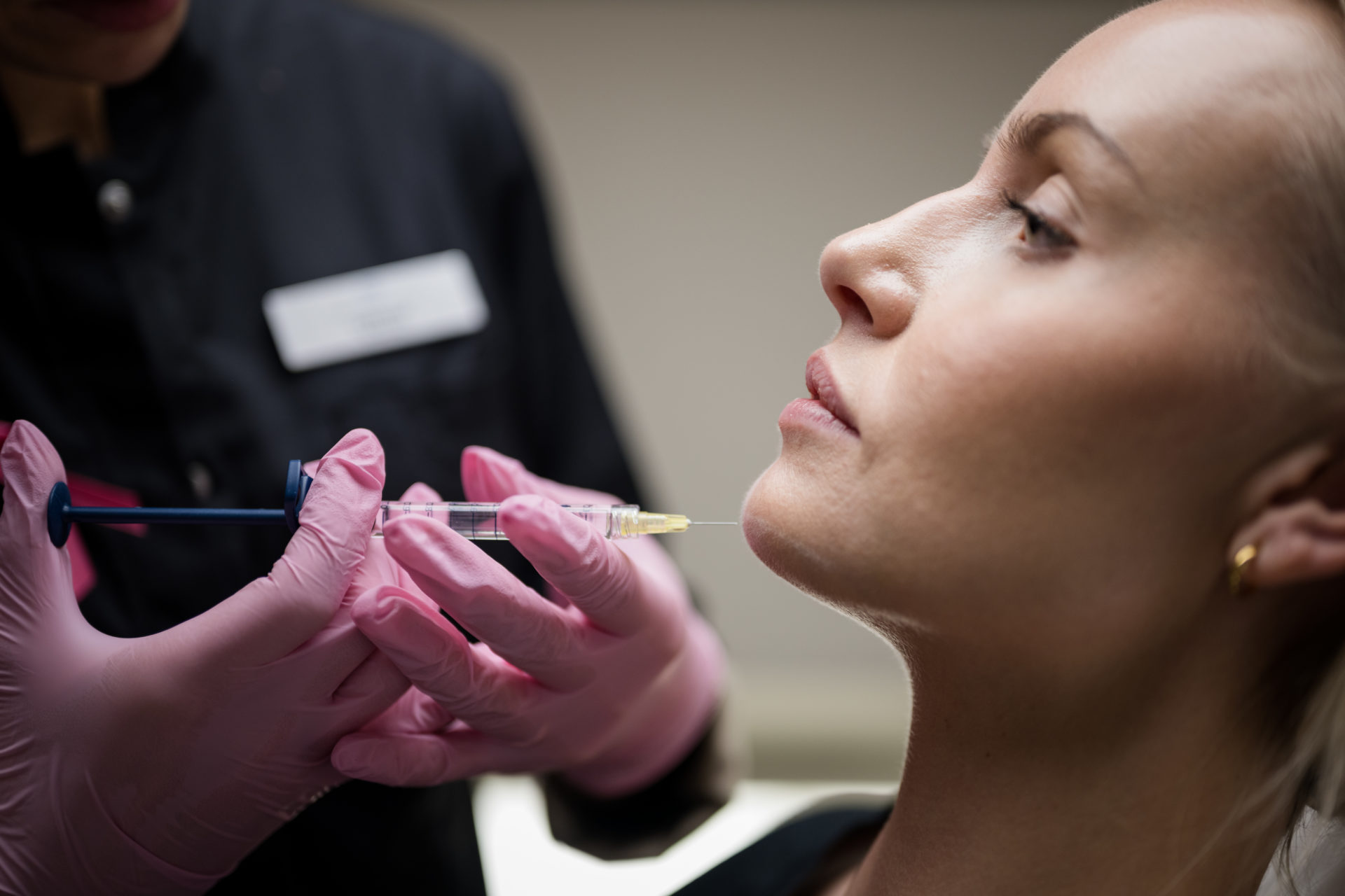 Fillers - Haka - Svenska Hudkliniker