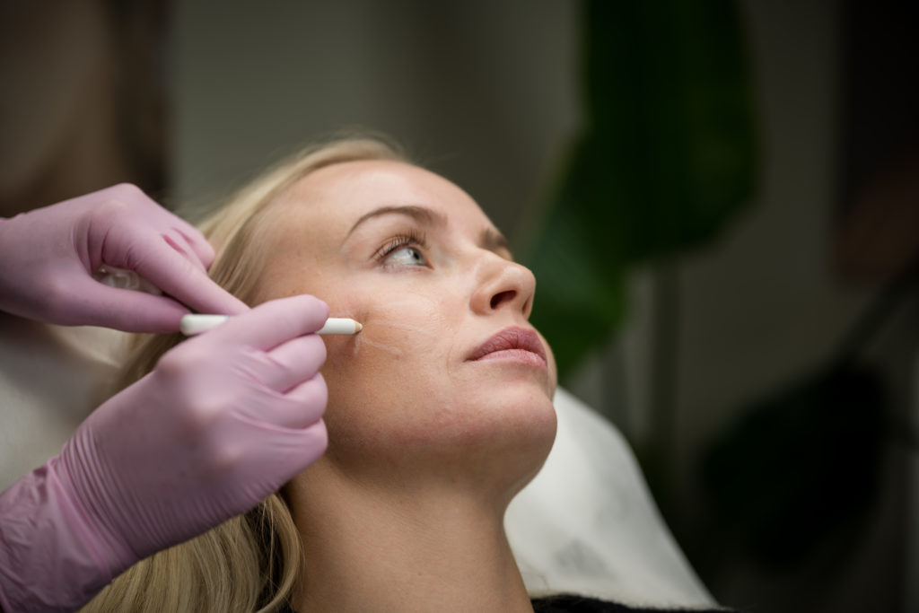 Fillers - Svenska Hudkliniker